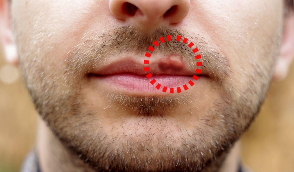 Why Does The Roof Of Your Mouth Hurt? Causes & Treatment